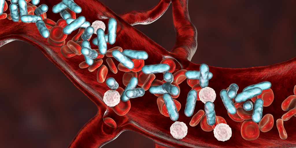 Sepsis - Nasjonalt senter for aldring og helse
